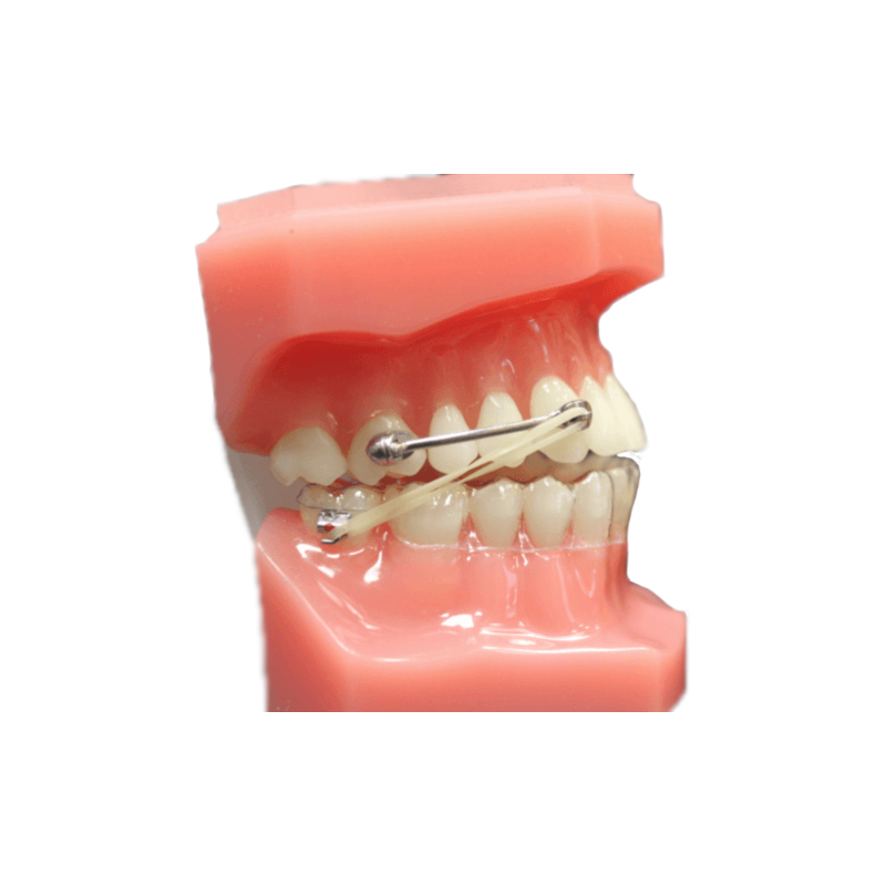 Carriere Motion 3D Metálico (Par) - Orthoghia