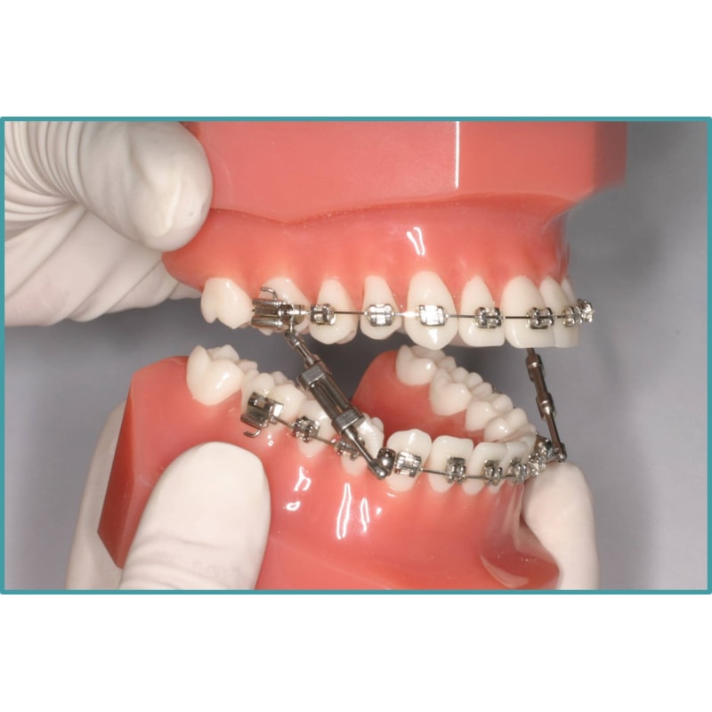 Twin-Force Bite Corrector Standard - Orthoghia