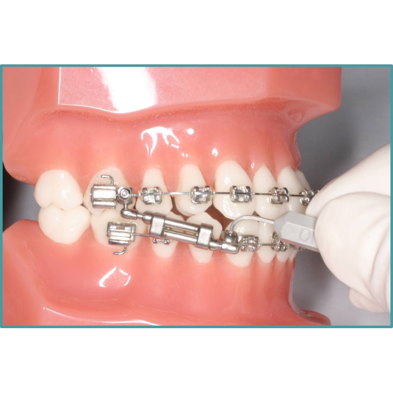 Twin-Force Bite Corrector Standard - Orthoghia